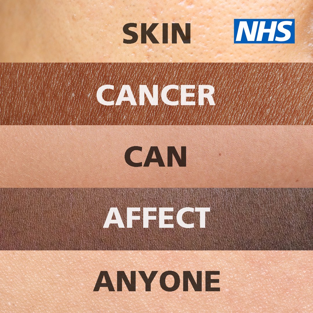 No matter your complexion, always use sun protection! – Heathcote ...